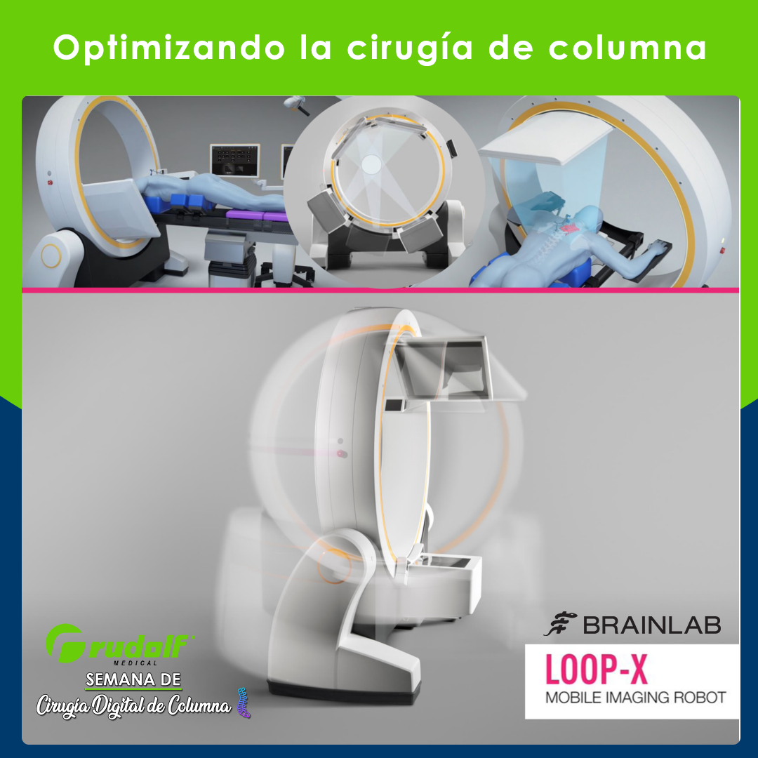 LOOP-X Optimizando la cirugía de columna