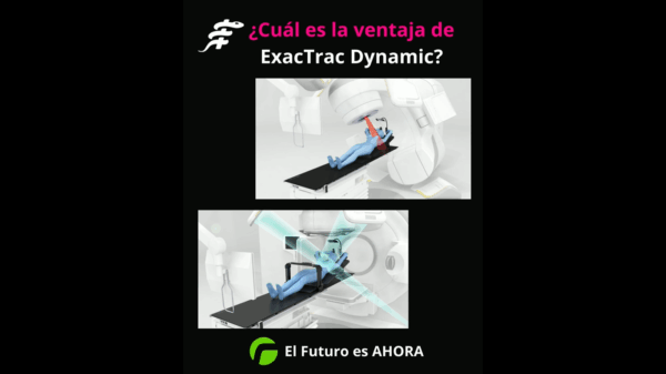 ¿Cuál es la ventaja de ExacTrac Dynamic? - Rudolf Chile S.A.