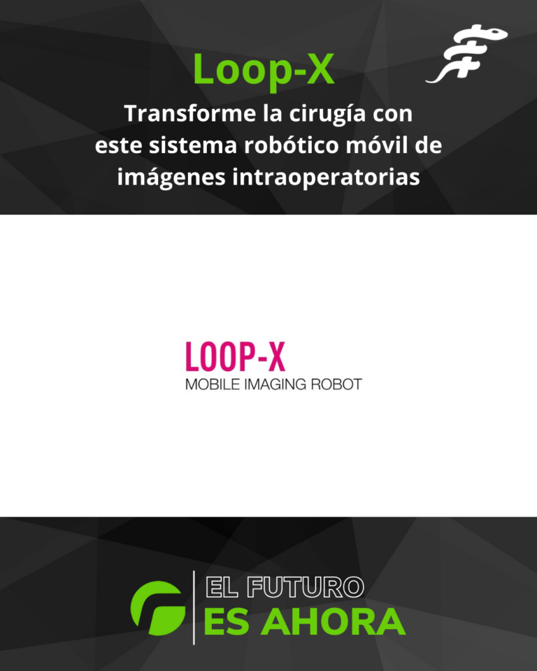 Loop-X Transforme la cirugía con este sistema robótico móvil de ...