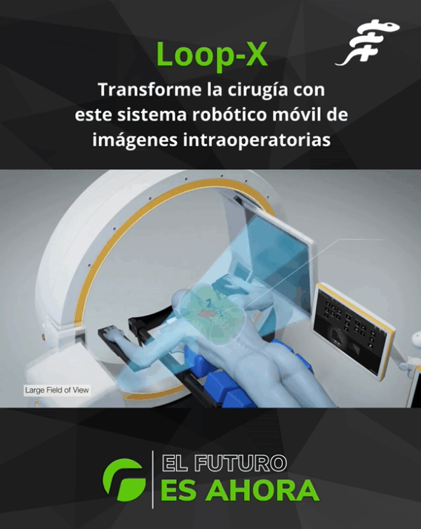 Loop-X Transformando la cirugía con imágenes robóticas móviles - Rudolf Chile S.A.