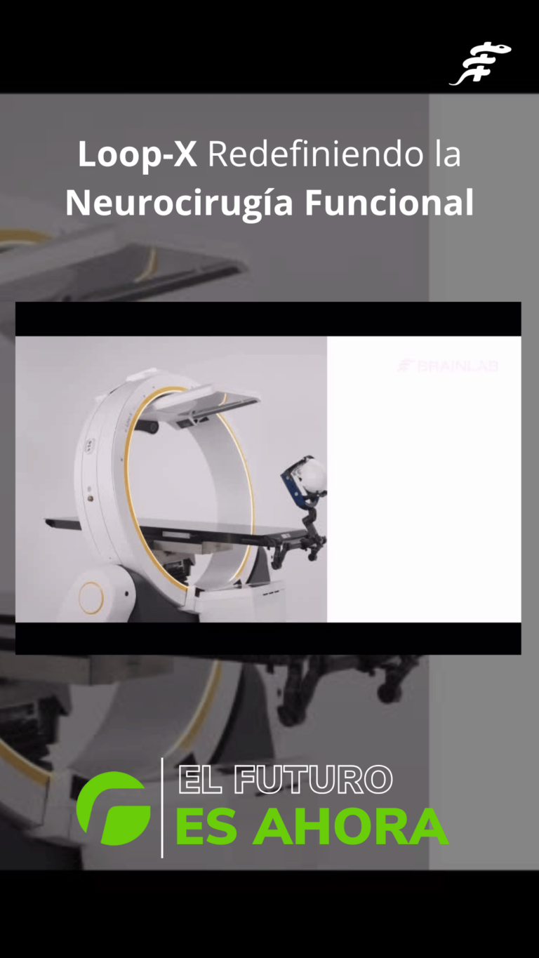 Loop-X Redefiniendo la Neurocirugía Funcional - Rudolf Chile S.A.
